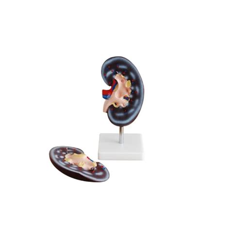 Medical Science PVC Platics Life Size Kidney Model Parts Human Anatomy Kidney Models