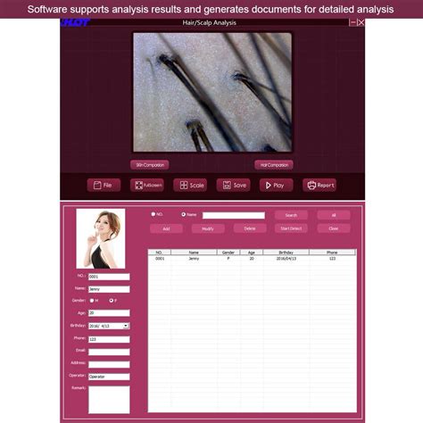 Digital Microscopeusb Skin Hair Scalp Detector Digital Microscope Skin