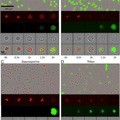 Quantification Of Netosis By Incucyte Zoom Compared With Fluorescence Download Scientific