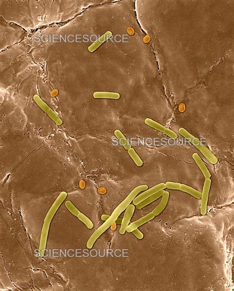 Bacillus Anthracis Spore Prokaryote Stock Image Science Source Images