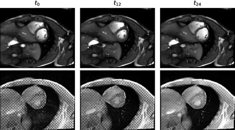 Figure 1 From Myocardial Segmentation Of Tagged Magnetic Resonance