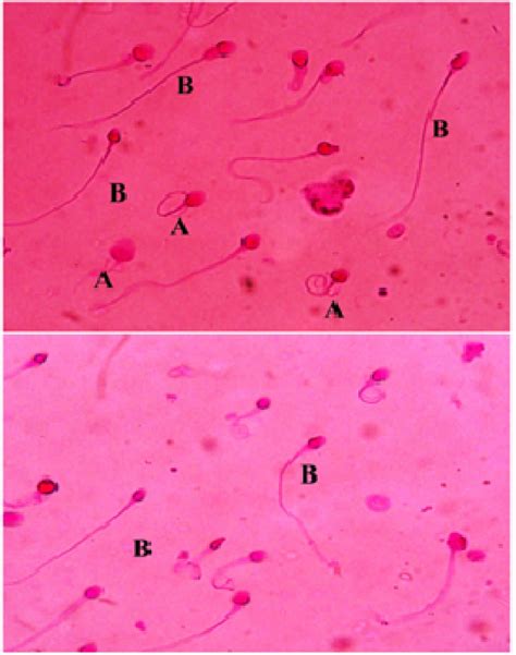 Response Of Spermatozoa For Hypo Osmotic Swelling Hos Test A Download Scientific Diagram