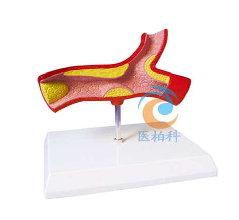 动脉血管模型 上海柏州科教设备有限公司