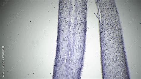 Root Tip Of Allium Cepa In Longitudinal Section Magnified By Microscope
