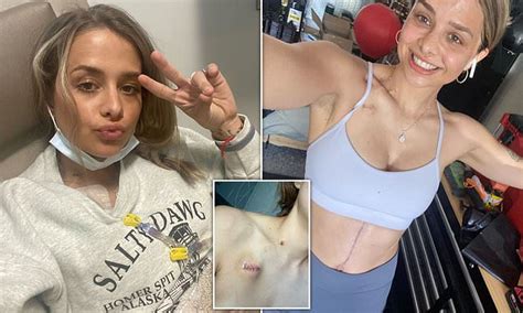 Woman Reveals How She Was Diagnosed With Stage Three Colon Cancer At After She Began