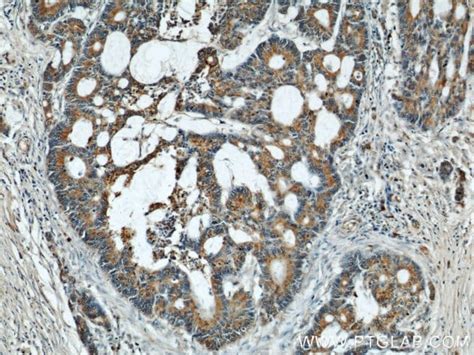 Alpha Tubulin Rabbit Anti Human Mouse Rat Polyclonal Proteintech