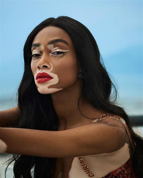 Hd Winnie Harlow In Dior Photographed By Jason Hetherington With Makeup By Naoko Scintu For