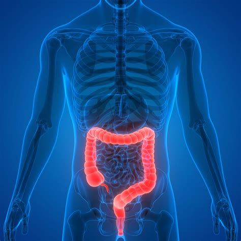 Colorectal Cancer American Institute For Cancer Research