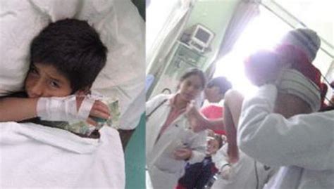 Cuatro niños sufren graves quemaduras PERU CORREO