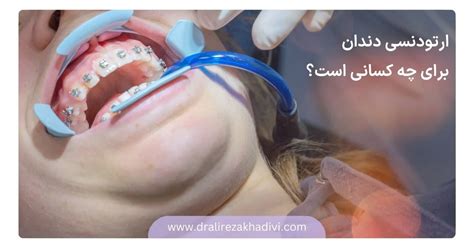 ارتودنسی دندان چیست؟ 0 تا 100 انواع، مراحل و مزایا ارتودنسی
