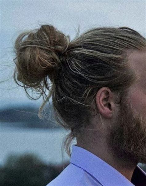 Hair Thinning On One Side Of The Head Causes And Treatments