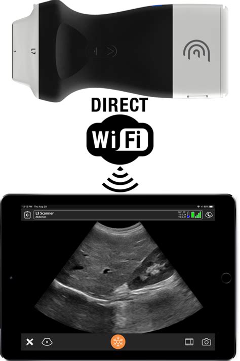Clarius Ultrasound Alpha Medtech Limited