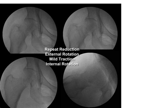 Nof Fixation Sequence Ppt