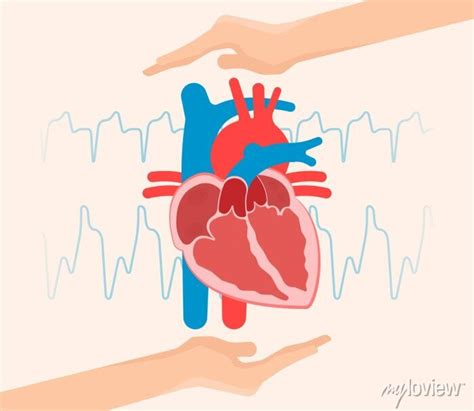 Cath Lab Atrial Septal Defect Tetralogy Of Fallot Patent Foramen Wall