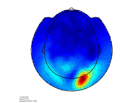 Whole Brain Connectivity And Network Analysis Fieldtrip Toolbox