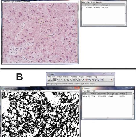 A Methodology Used To Quantify The Nucleus And Cytoplasms Area In Download Scientific