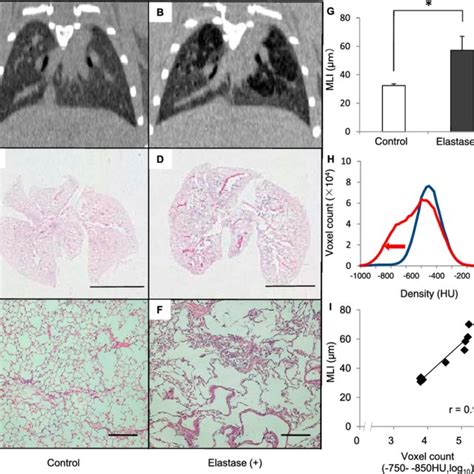 Histomorphometric Correlation With Two Dimensional Computed Tomography Download Scientific