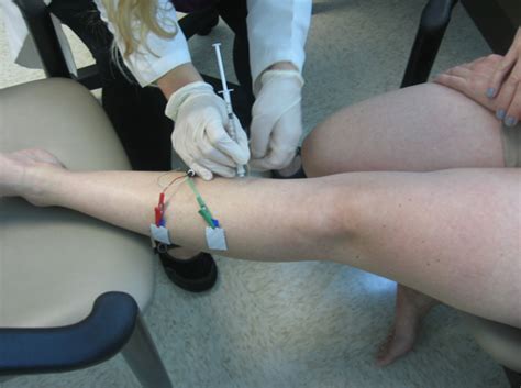 Botox Treatment For Spasticity Improves Lives Hsp Research Foundation