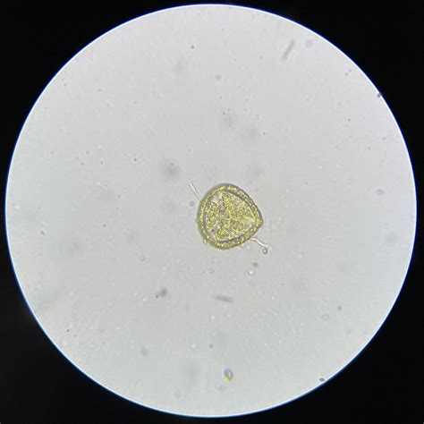 Through The Porthole Ep 12 Sphagnum Spores Rsphagnum