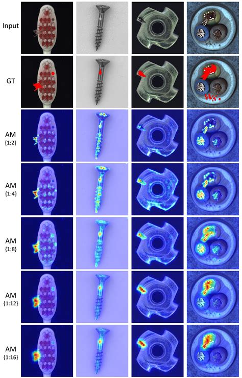 Dfr Deep Feature Reconstruction For Unsupervised Anomaly Segmentation