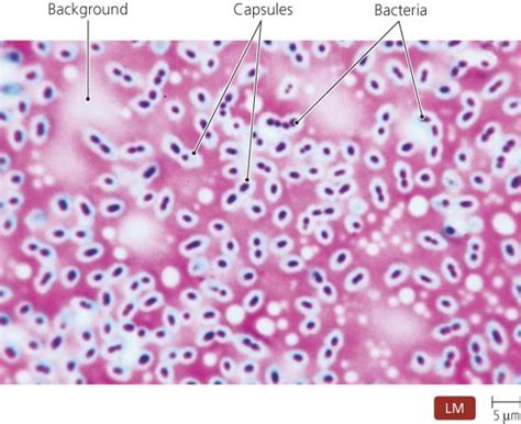 Anthrax Funny Quotes Quotesgram