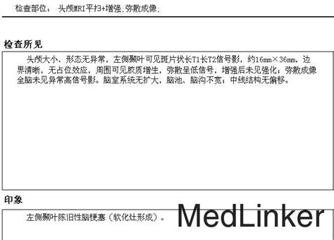 头晕需仔细甄别 医联