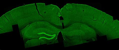 Researchers Invent New Method for Non-Invasive Deep Brain Stimulation - IEEE Spectrum