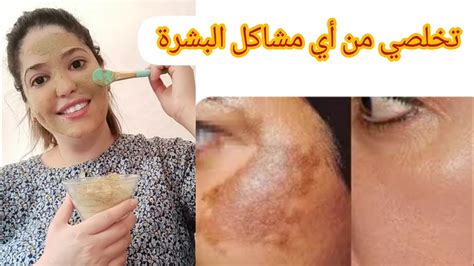 تجربتي مع ماسك عرق السوس لتبييض الوجه و تفتيح البشرة وإزالة التصبغات