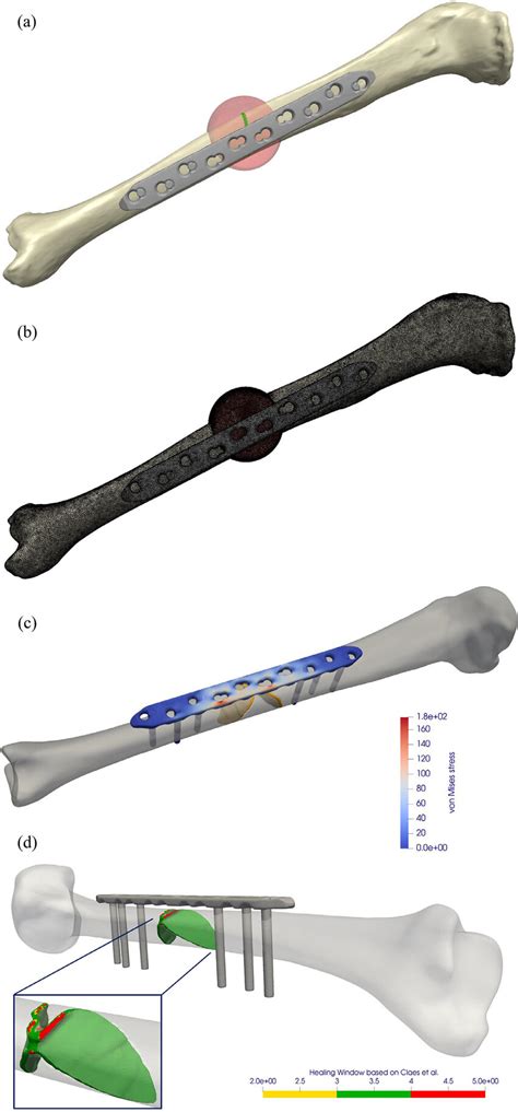 Computer Models A Integrating A Human Tibia Ct Data Set With Cad Data