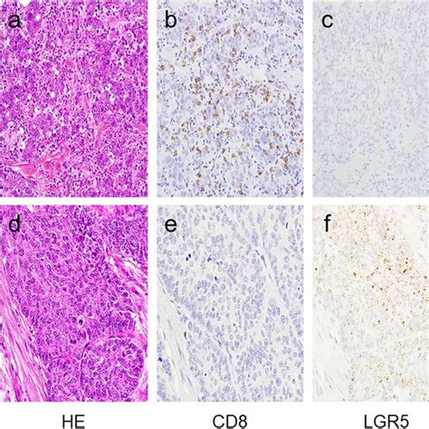 Representative Images And Staining Of Mmr P And Mmr D Cases