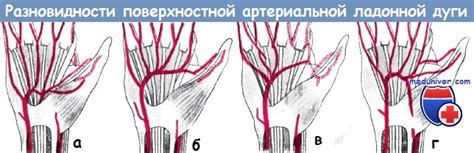 Первая помощь при повреждении сосудов артерий вен кисти