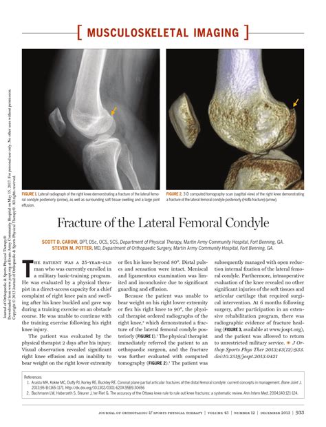 Pdf Fracture Of The Lateral Femoral Condyle
