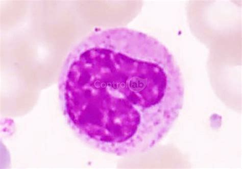 Hematología Hemograma Serie Blanca Controllab