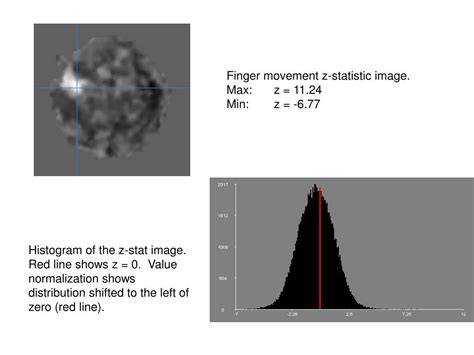 Ppt Statistical Parametric Mapping Powerpoint Presentation Free Download Id 5881364
