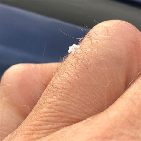 The Role Of Miniaturization In The Evolution Of Implantable Electronics