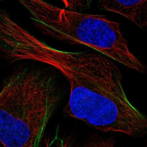 V Atpase H Antibody Pa5 54793