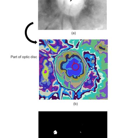 Major Stages Of Optic Disc Roi Extraction Technique Download