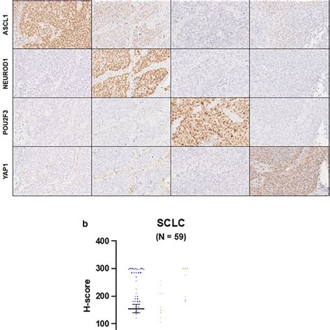 Immunohistochemistry Ihc Expression Patterns And Score Of Sclc A