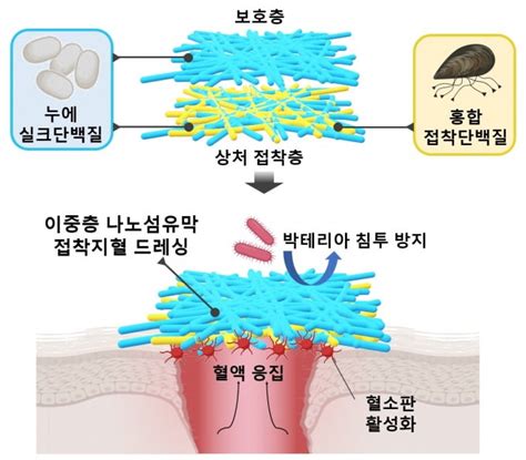 홍합누에고치로 출혈 막는다 국내 연구진 새로운 지혈제 개발 │ 매거진한경