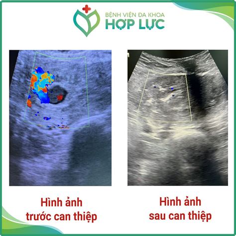 Bộ Sưu Tập Hình ảnh Cấp Cứu đồ Sộ Top 999 Hình ảnh Cấp Cứu Chuẩn 4k