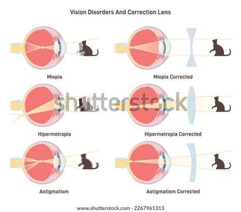 Myopia Hyperopia Astigmatism Common Vision Disorders Stock Vector Royalty Free 2267961313