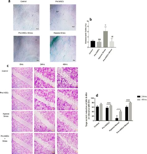 Cellular Migration And Senescence Analysis A Crystal Violet Stained