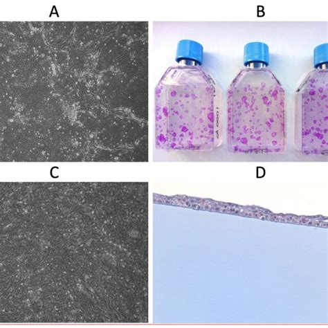 Identification Of Corneal Epithelial Cells After Each Cell Isolation