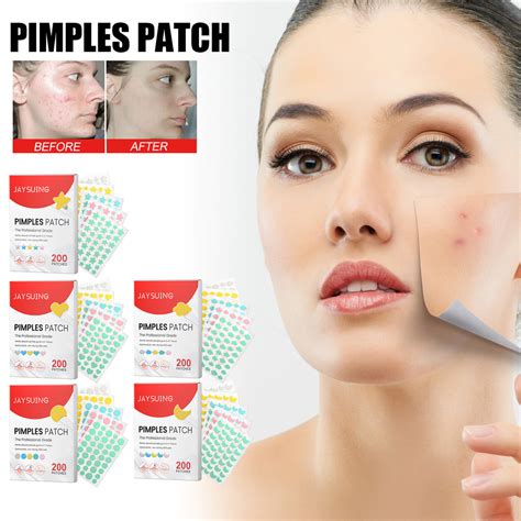 200pcs180pcs Colorful Acne Treatment Sticker Invisible Acne Cover