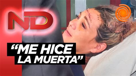 Mujer Baleada En La Cabeza Me Pidieron Plata No Me Resistí Pero Me