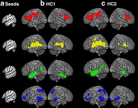 Identification And Reproducibility Of The Intrinsic Language Networks Download Scientific