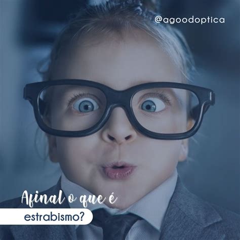 Estrabismo é O Desalinhamento Dos Olhos Quando Os Olhos Não Estão