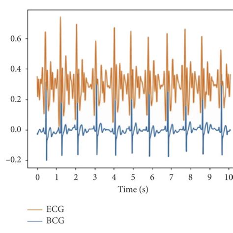 Pdf Resnet Bilstm A Multiscale Deep Learning Model For Heartbeat Detection Using