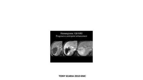 Hepatobiliary System Radiology Revision Notes Pdf