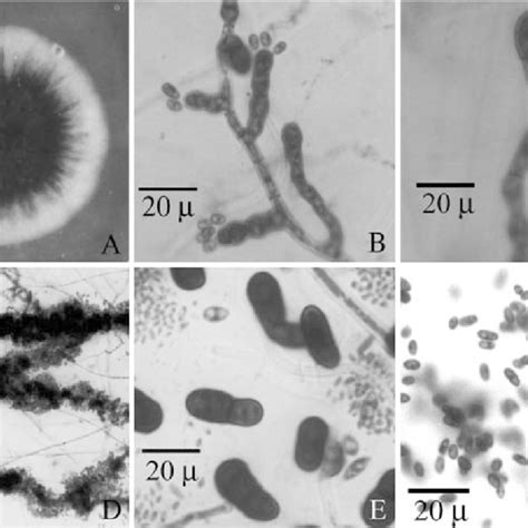 Pdf Characterization Of Aureobasidium Pullulans Isolated From